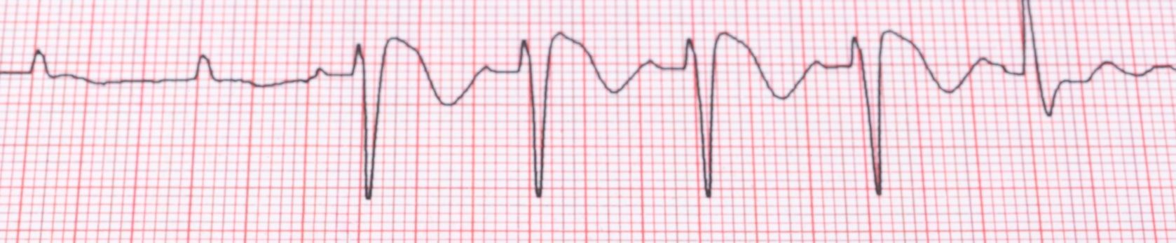 Cardio-Diagnostic Testing - TotalCardiology